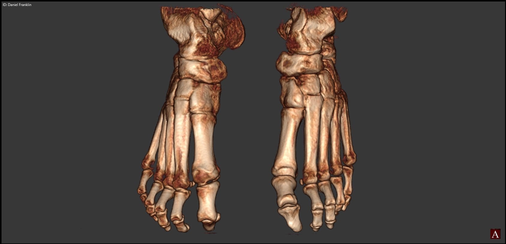 CurveBeam CT Imaging Technology is Right On Point - Curvebeam