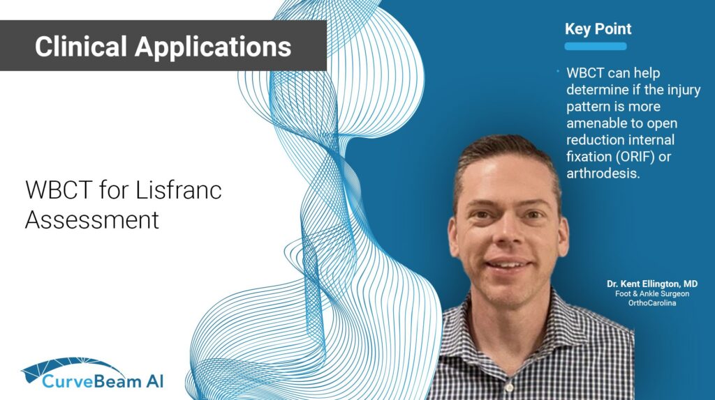 WBCT Indications Series: Lisfranc - CurveBeam AI