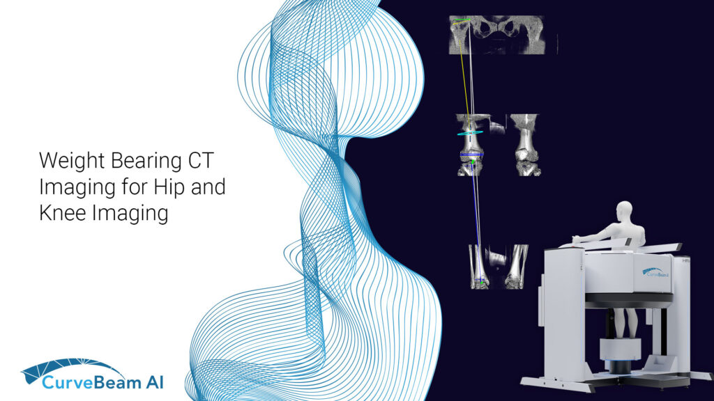 CurveBeam AI - bilateral, weight bearing 3D views of the foot, ankle ...
