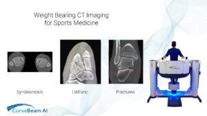 CurveBeam AI - bilateral, weight bearing 3D views of the foot, ankle ...
