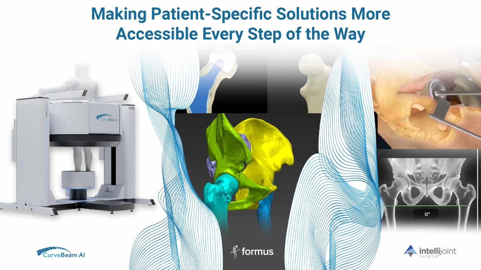 CurveBeam AI - bilateral, weight bearing 3D views of the foot, ankle ...