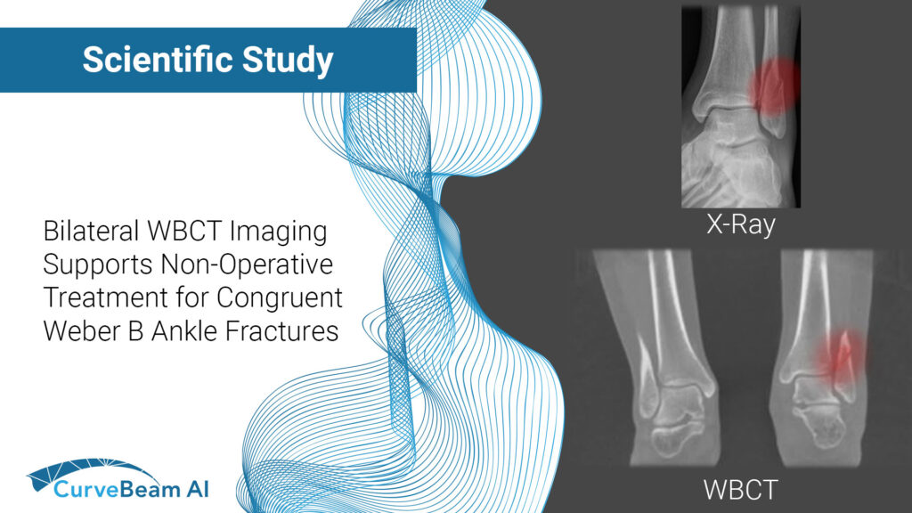 Congruent Weber-B Ankle Fractures Do Not Alter Tibiotalar Contact ...